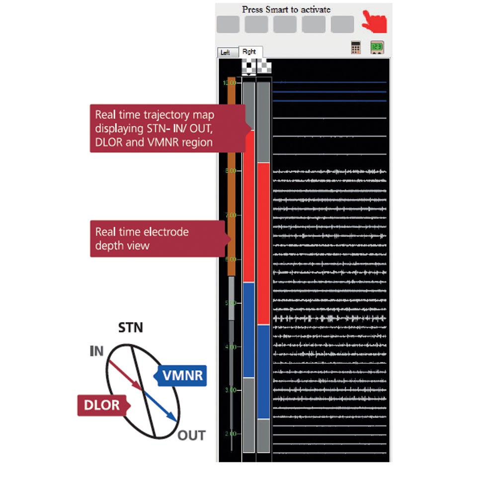 功能神经外科一体化电生理平台-滔博生物