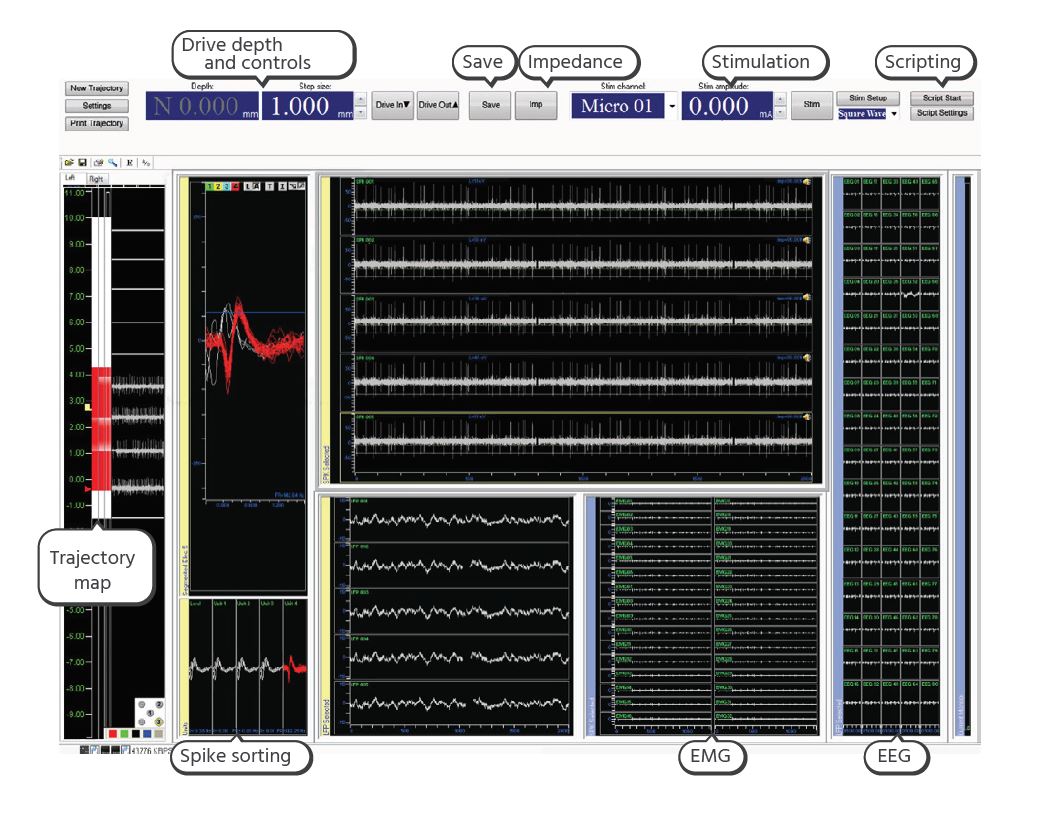 功能神经外科一体化电生理平台-滔博生物
