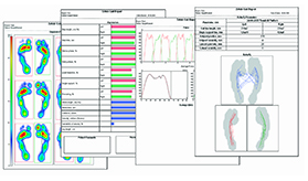 ZEBRIS_压力分布跑台_TEKSCAN_walkway_足底压力分布_压力分布跑台_FOOTSCAN_压力分布系统